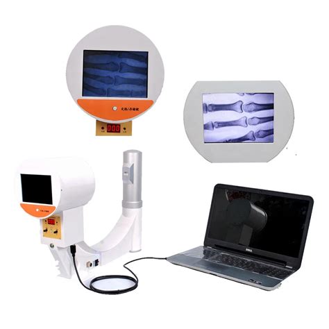 Portable X Ray And Fluoroscopy Machine Advanced Imaging On The Go Meubon