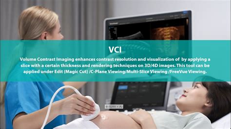 Volume Contrast Imaging And Vci With Freevue Youtube