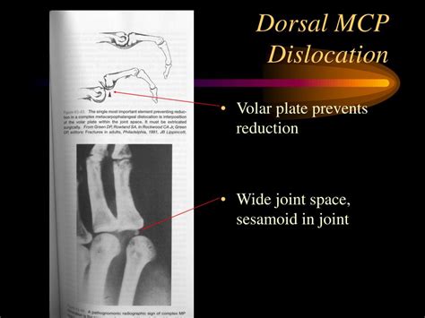 Ppt Hand Rounds Oct 31 2002 Rob Hall Md And Lisa Campfens Md Frcpc Powerpoint Presentation