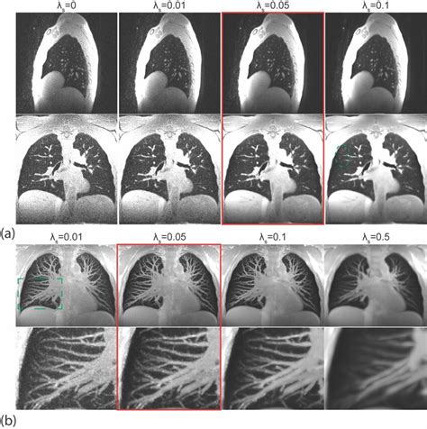 effect of tgv sparse constraint parameter λ on the imoco download