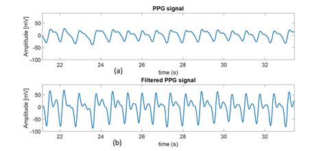 A Original Ppg Signal And B Filtered Ppg Signal Download