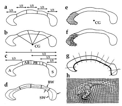 Corpus Callosum Anatomy