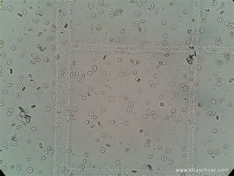 Microscopio De Eritrocitos Eritrócitos Sob Um Microscópio Foto