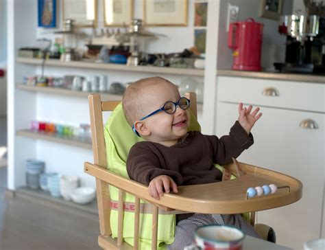 Rethink Glasses In Infants With High Astigmatism Hyperopia