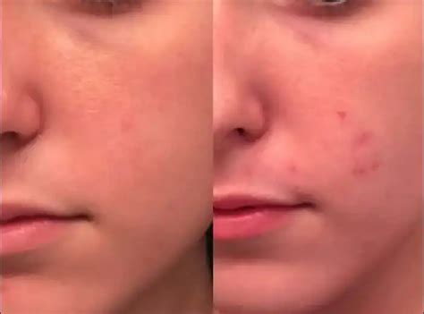 کرم ویتامین سی اوردینری ٪۲۳ و ۲٪ هیالورونیک اسیدبهترین قیمتاصل کانادا