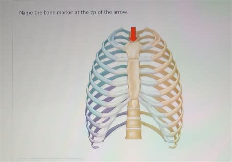 Solved Name The Bone Marker At The Tip Of The Arrow Name