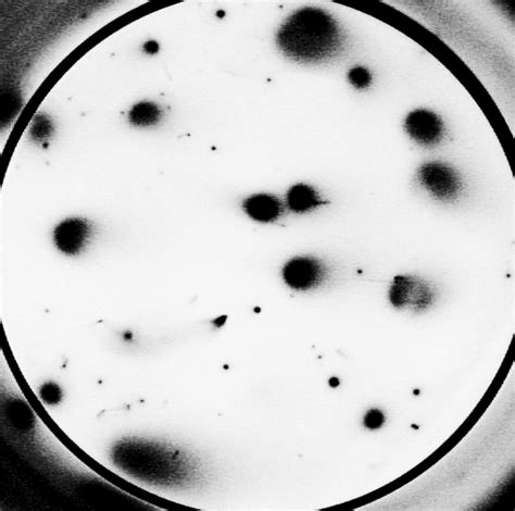 Monitoring Antibody Secreting Cells With The B Cell Elispot U Cytech Biosciences