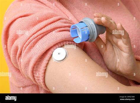 Woman With Glucose Sensor For Measuring Blood Sugar Level And