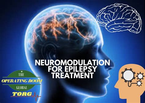 Neuromodulation For The Treatment Of Epilepsy The Operating Room Global Torg