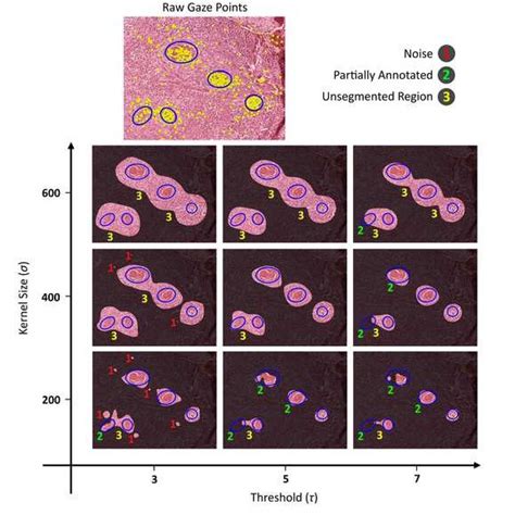 Impact Of Thresholding And Kernel Size Higher Threshold Values Reduce