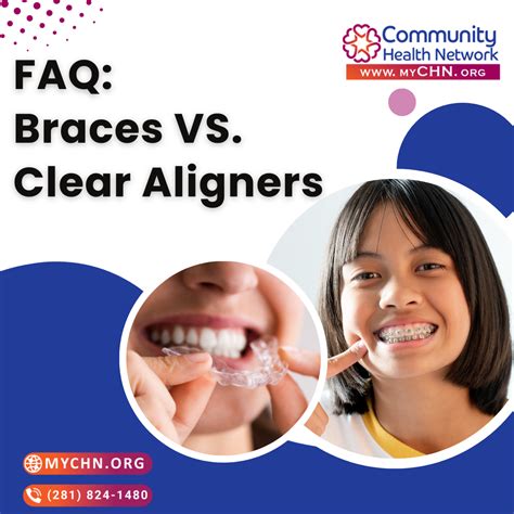 Faq Braces Vs Clear Aligners