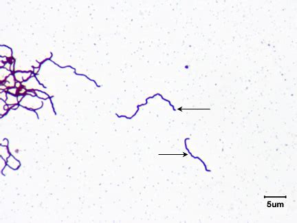 Photomicrograph Of Treponema Pallidum