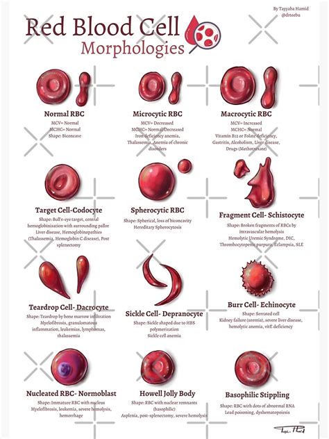 Rbc Morphologies Poster For Sale By Drteebu Redbubble