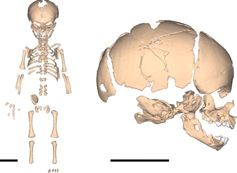 Neanderthal Brain Size At Birth Provides Insights Into The Evolution Of