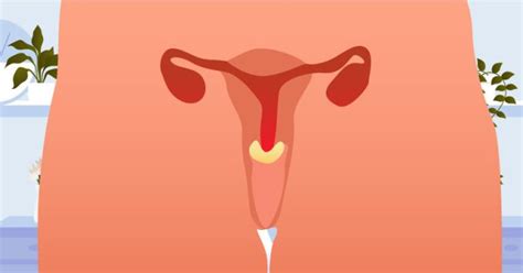 How To Prevent Vaginal Bleeding After Sex No More Mess