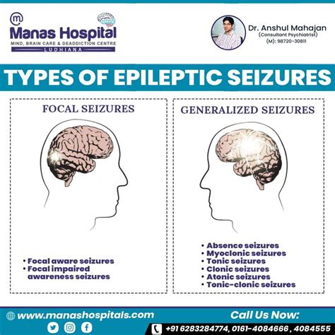 epilepsy seizure symptoms