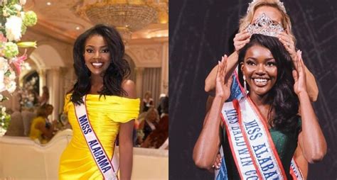 Seminggu Bertarung Dengan Koma Ini Kisah Kematian Tragis Ratu Cantik Alabama