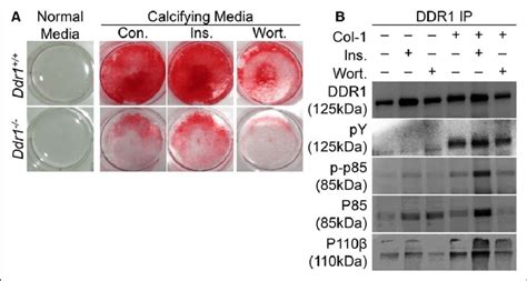 Discoidin Domain Receptor 1 Ddr1 Mediates Vascular Smooth Muscle Cell Download Scientific