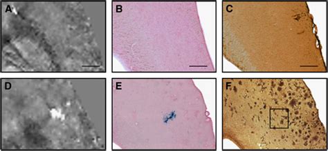 Comparison Of Quantitative Susceptibility Maps Qsms Of An 18 Month