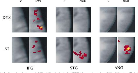 Structure Of Angular Gyrus Semantic Scholar