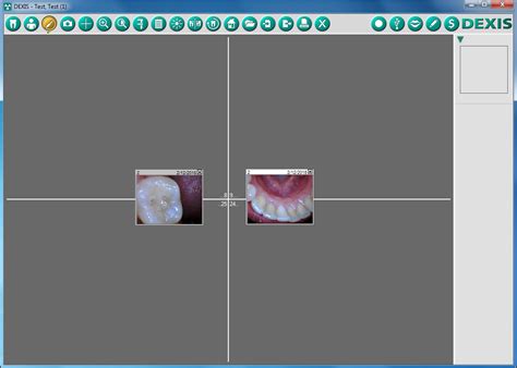 Dexis 10 Ioc Snapshot