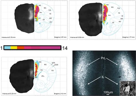 Medial Prefrontal Cortex