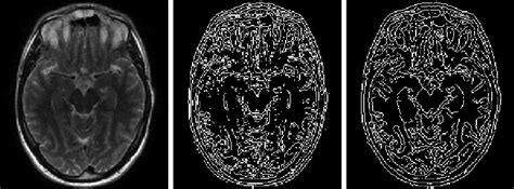 Original Image A Compared With Its Edges Detected Using Sobel B And