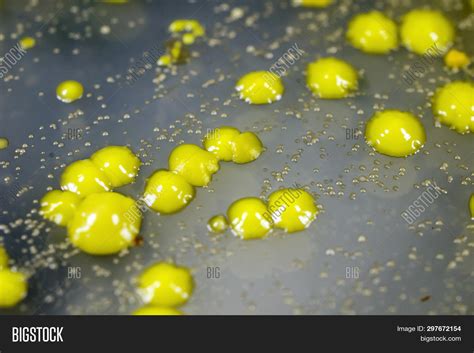 Bacteria Grown From Skin Smear Colonies Of Micrococcus Luteus And