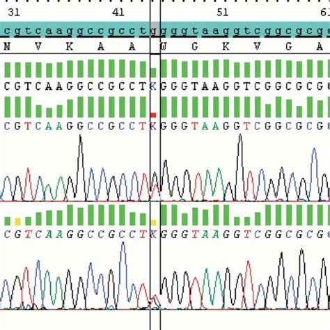 The Hplc Chromatogram Of The Index Patient Showing The Hb Variant Download Scientific Diagram