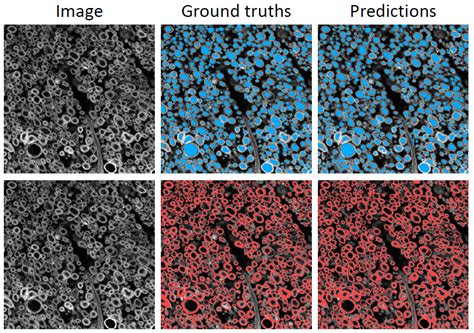 Microscopy Image Segmentation At Troy Musselman Blog