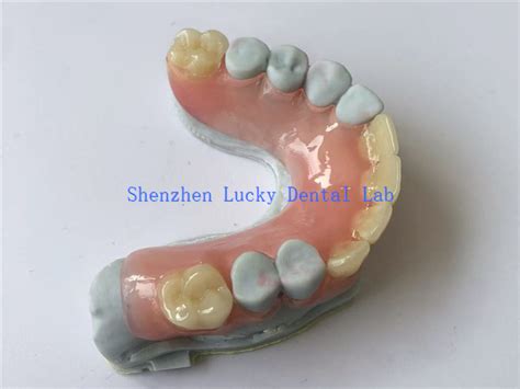 China China Customized Dental Partial Flexible Denture Dental Lab Manufacturers Suppliers Factory