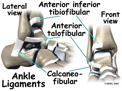 Proximal Distal Tib Fib Rt Leg Surgery Recovery Major Improvement