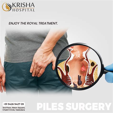 What Is Piles Piles Or ‘hemorrhoids Or Piles Are Blood