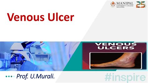 Venous Ulcer And Deep Vein Thrombosis Causes And Management Pdf