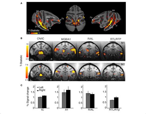 Mapping Auditory And Auditory Related Regions With Complex Sounds