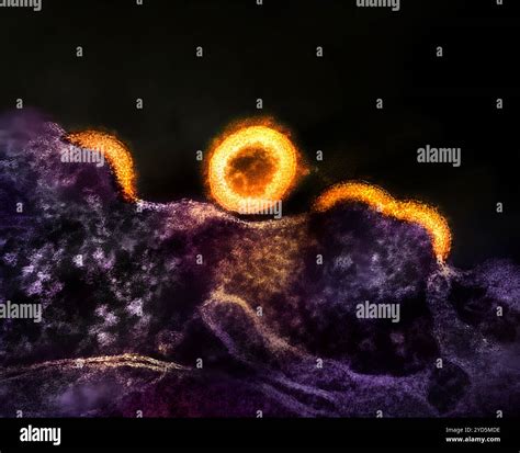 Transmission Electron Micrograph Of Hiv 1 Virus Particles Colorized