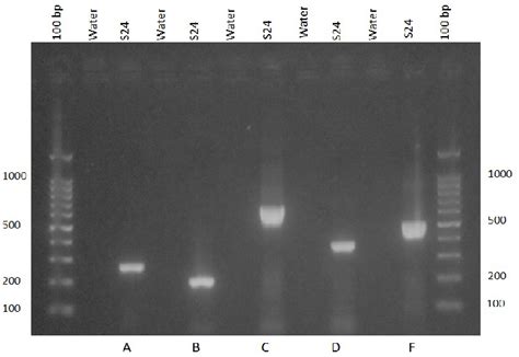 Pcr Amplification Products Of Antibiotic Biosynthetic Genes In Bacillus