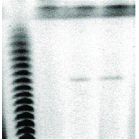 Electropherogram Of Plasmid Dna Of P Putida Strain Ch2 And P P