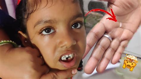 Danth Nikal Diya Behan Ka 😱 Youtube