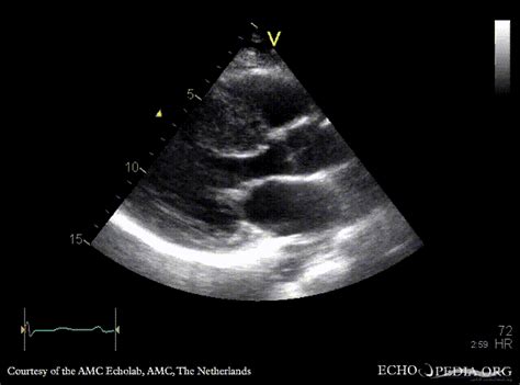 Case 91 Echopedia