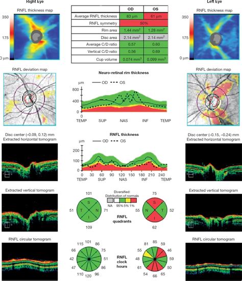 Tools And Tests For Multiple Sclerosis Musculoskeletal Key