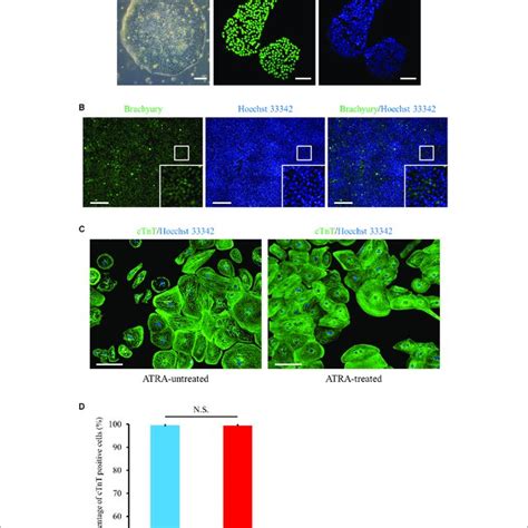 Differentiation Of Ipsc Into Three Germ Layers Formation Of Embryoid Download Scientific