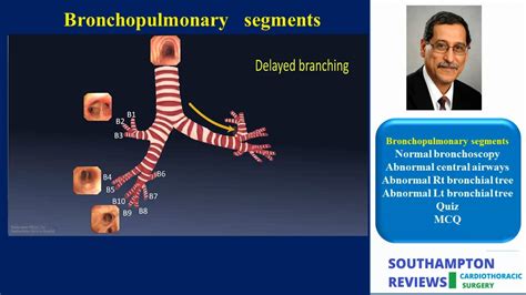 Bronchoscopy Anatomy