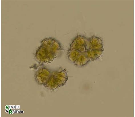 Botryococcus Terribilis Galerie