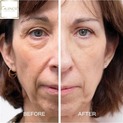 Guinot Visible Age Reverse Milton Keynes Mccarthy Skin Clinic