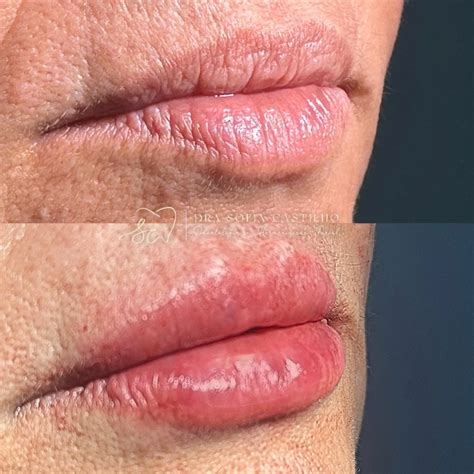 Dra Sofia Castilho Dentista Poá E Suzano Dra Sofiacastilho • Instagram Photos And Videos