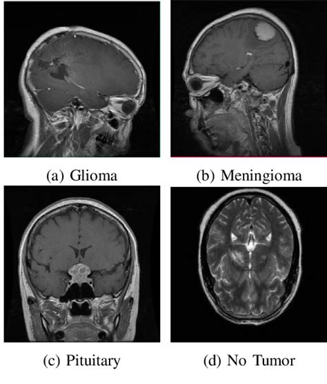 Figure 1 From Benchmarking Cnn And Cutting Edge Transformer Models For