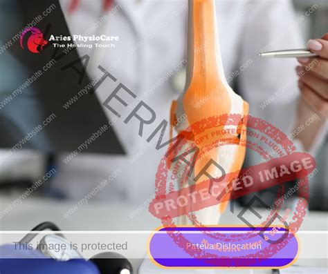 Patella Dislocation Aries Physiocare