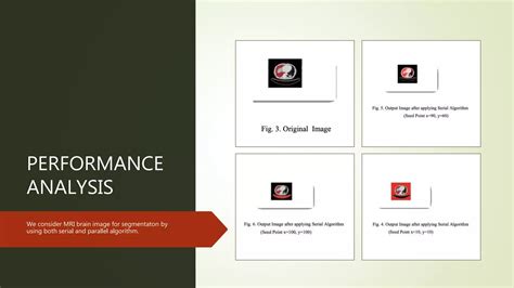 A New Approach For Parallel Region Growing Algorithm In Image Segmentation Using Matlab On Gpu