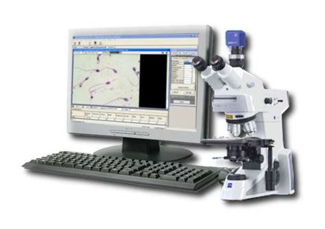 Automated Semen Analyser Automated Sperm Analyzer Latest Price Manufacturers Suppliers